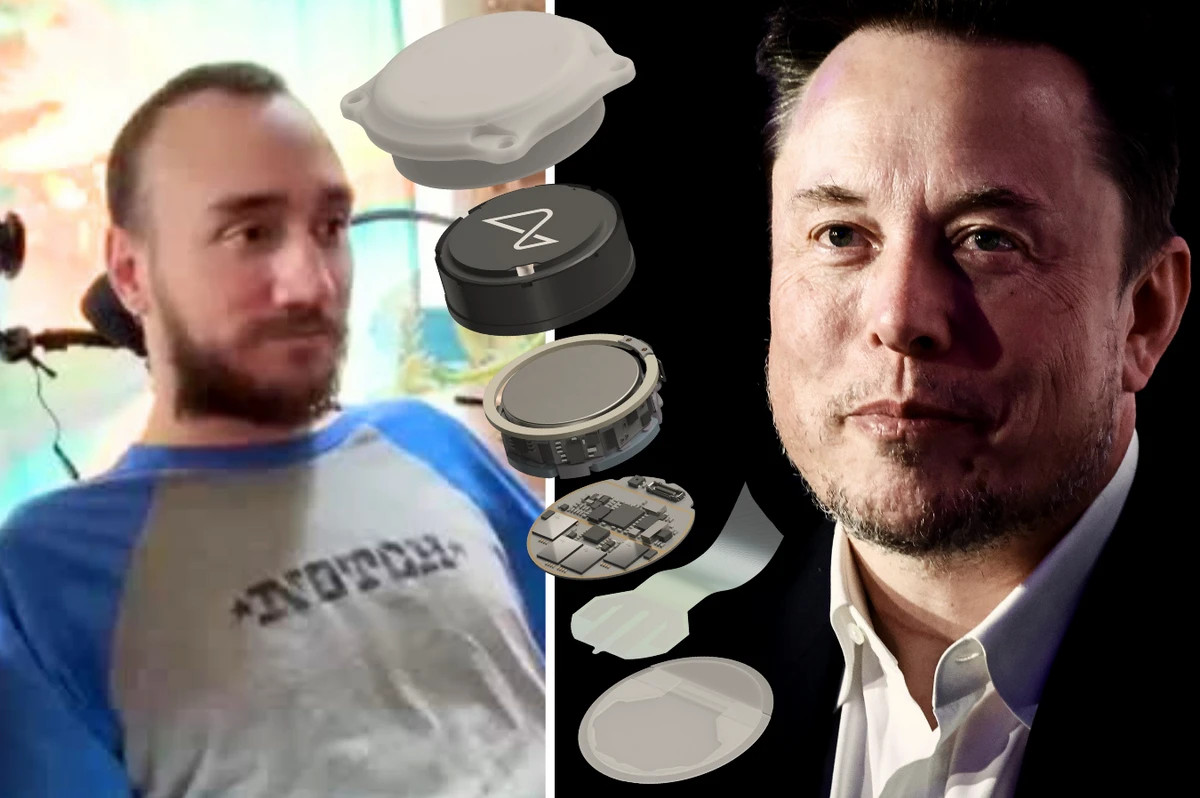 Elon Musk muestra cómo su primer paciente con chip cerebral juega ...