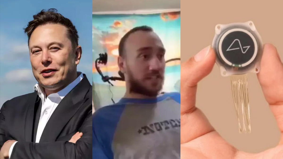 Elon Musk Y Neuralink Problemas Con El Primer Implante Cerebral